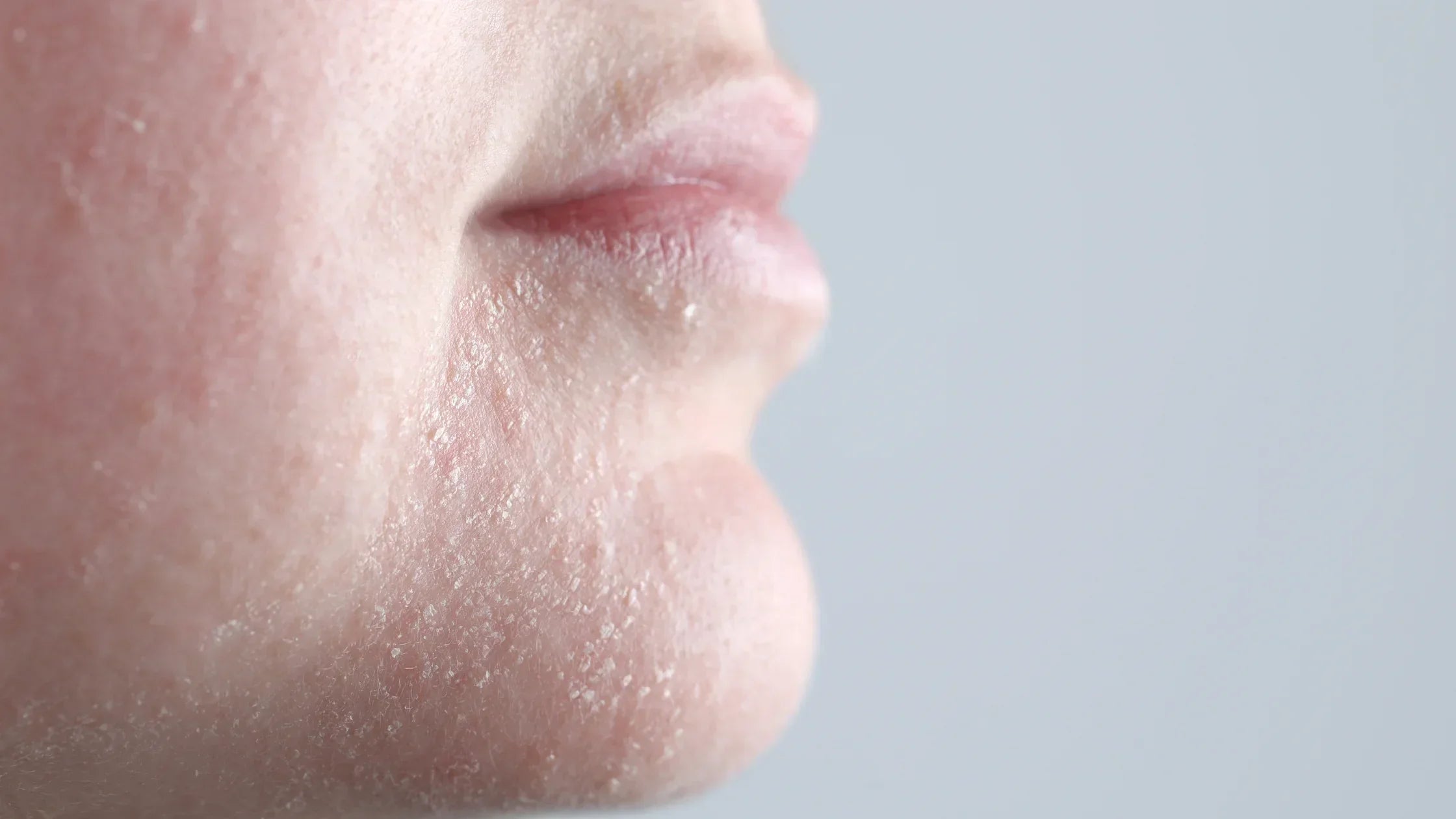 Peaux hypersensibles : 4 solutions pour apaiser votre peau réactive ...