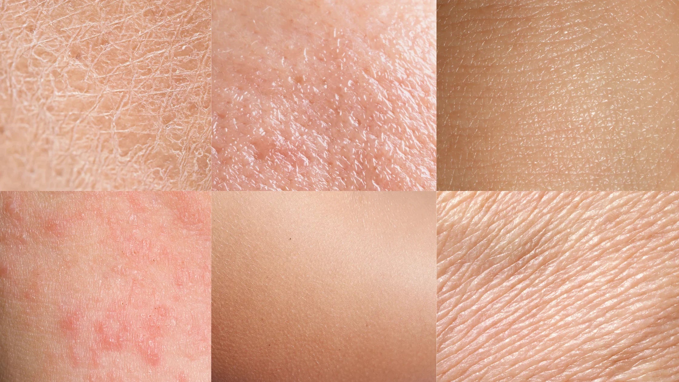 Reconnaître son type de peau : astuces et tests à faire chez vous – Hodygé